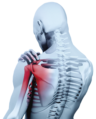Dolor de hombro - Medipase