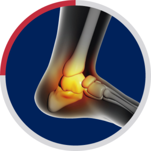 Dolor de tobillo - Medipase